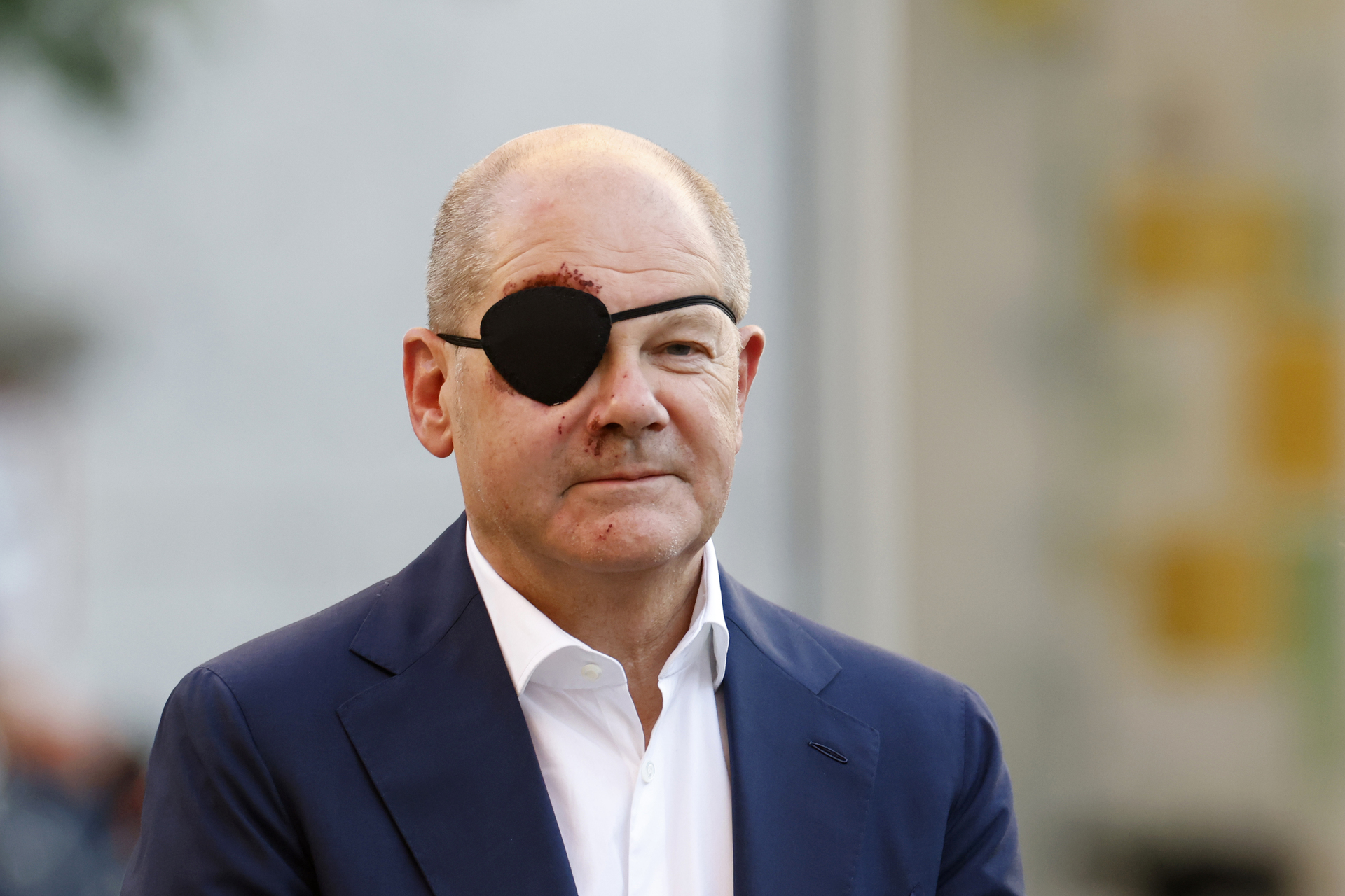 "Excited to see the memes": German Chancellor Scholz sports eye patch following jogging accident